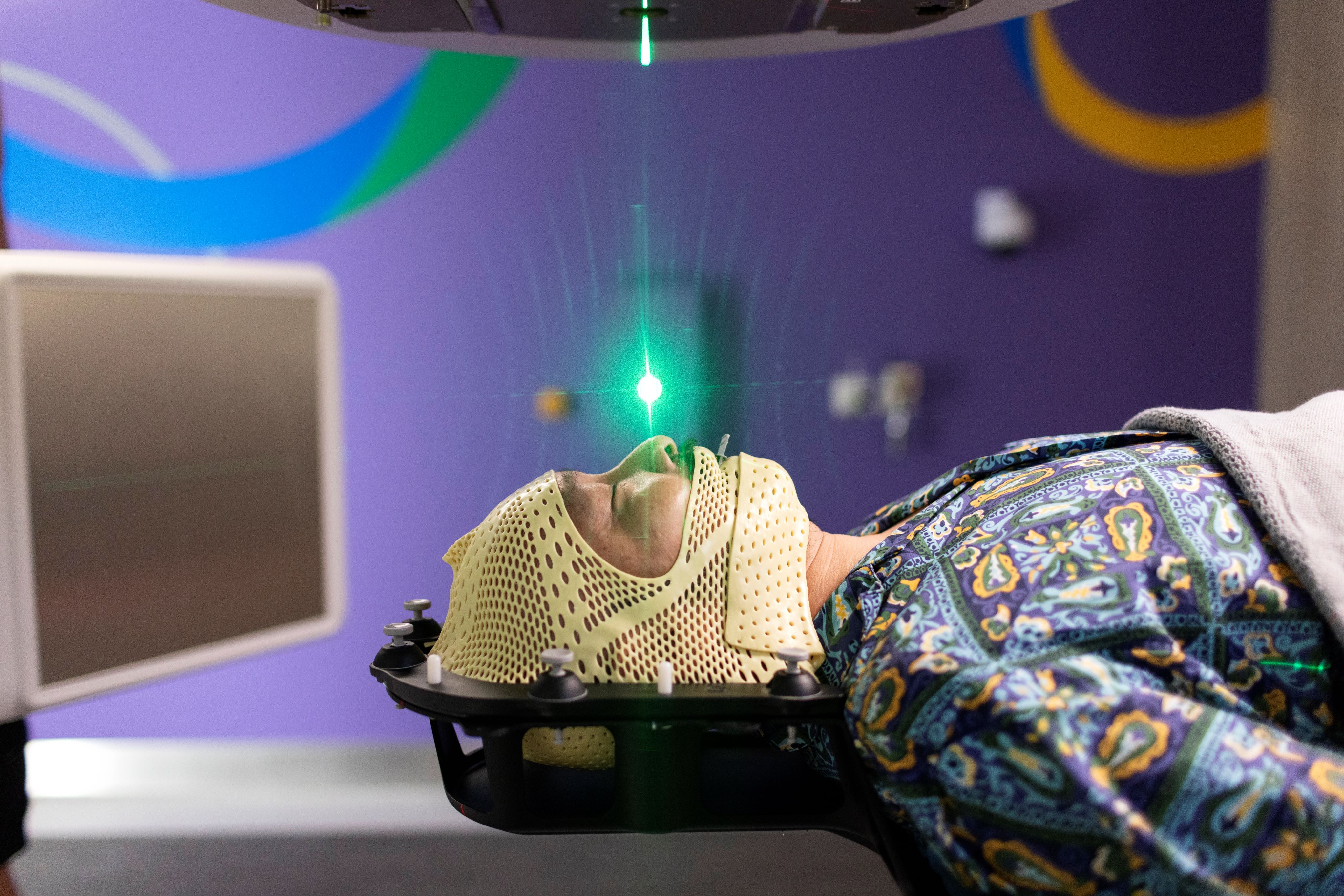 Skin reactions from radiation therapy | Icon Cancer Centre Indonesia